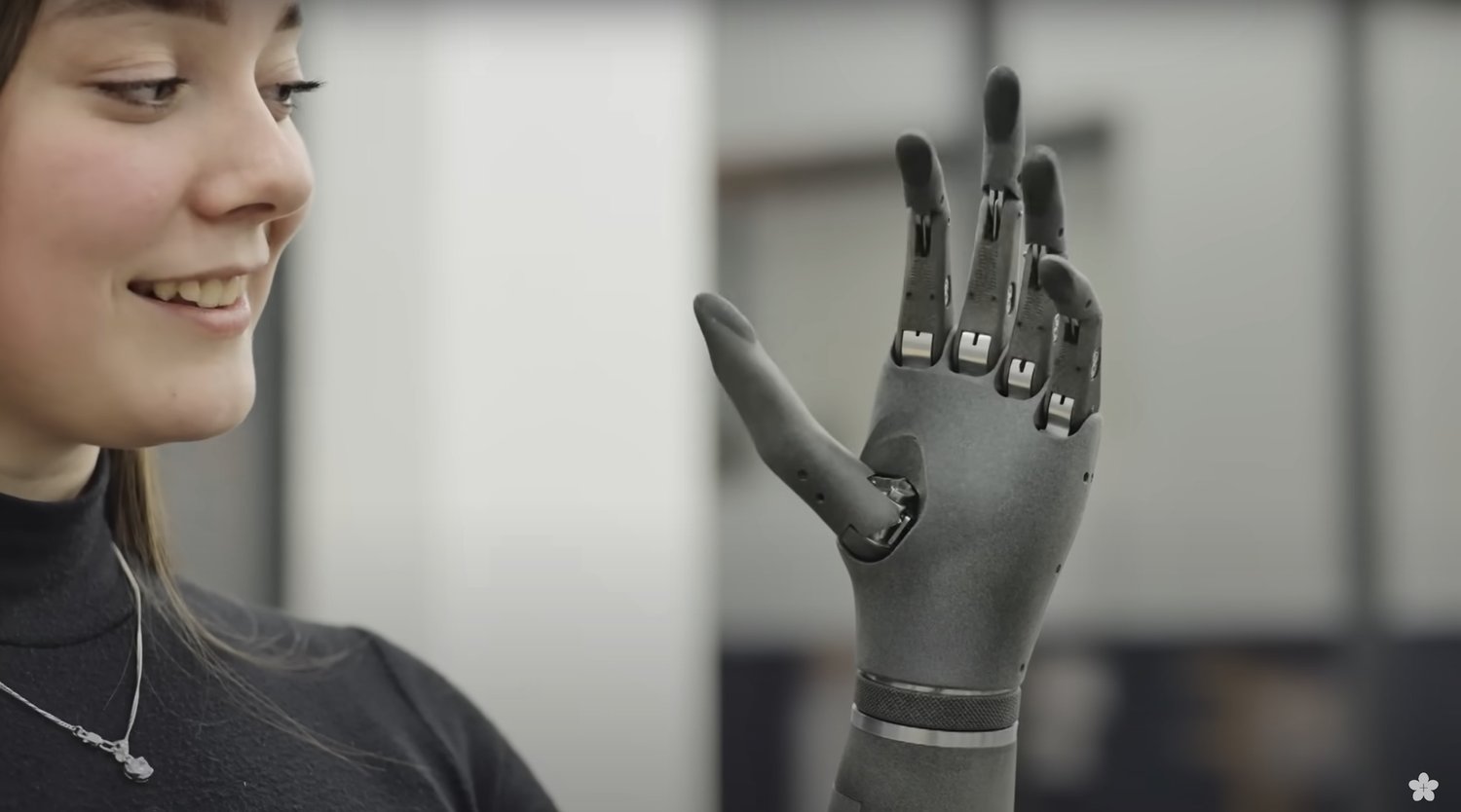 Check Out This Cool Robotic Prosthetic Hand That’s Powered by AI ...